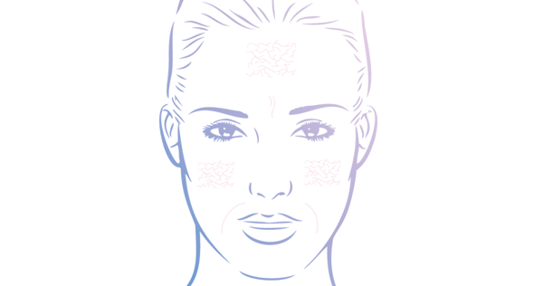 How Préime DermaFacial Work | Préime DermFacial® - Préime DermaFacial